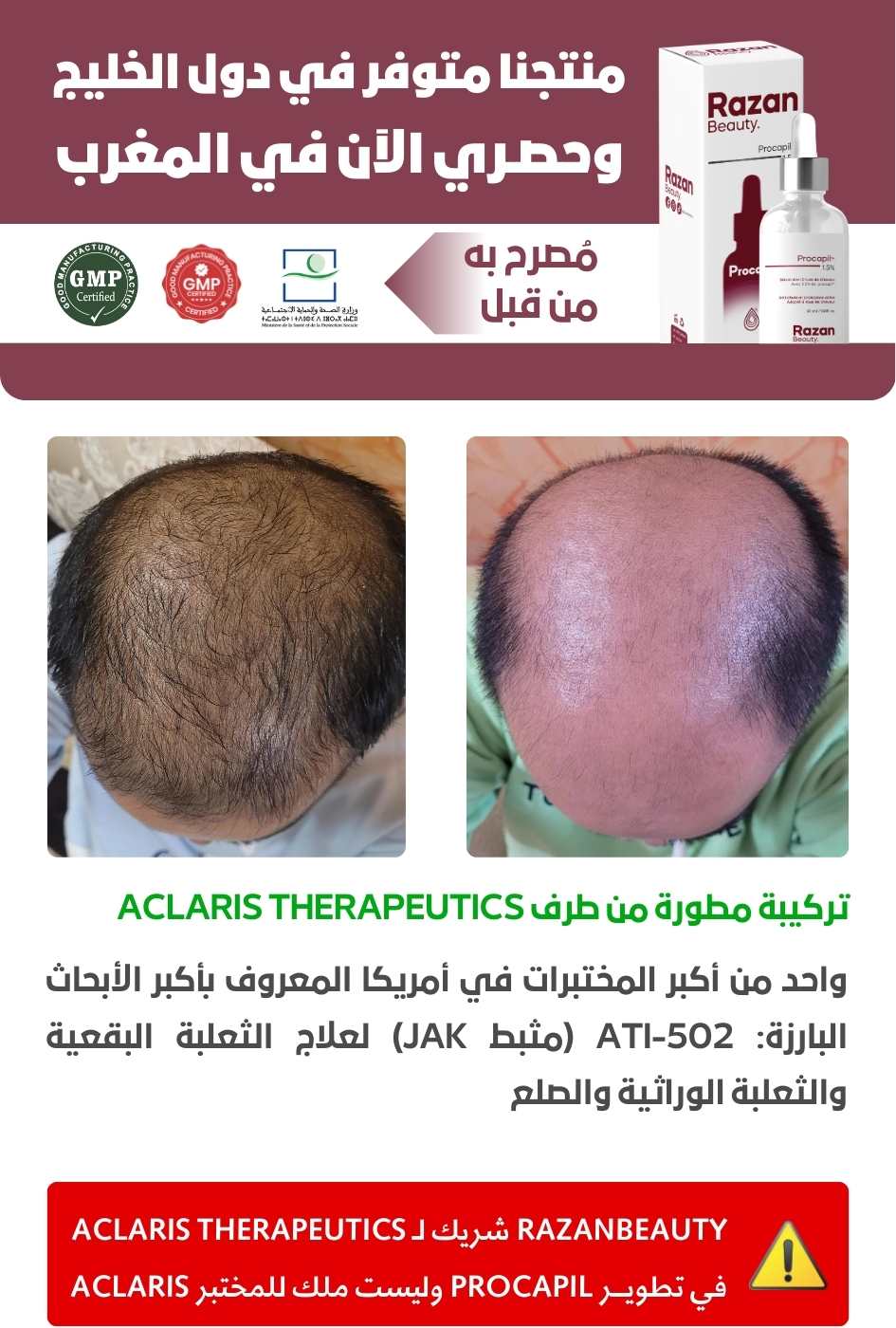 Home page - Razzan beauty